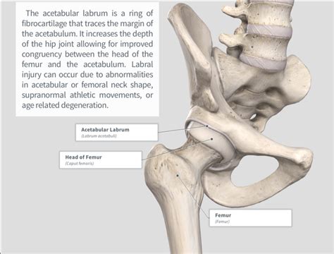 Acetabular Labrum Tear — Knowledge Central — Physiou