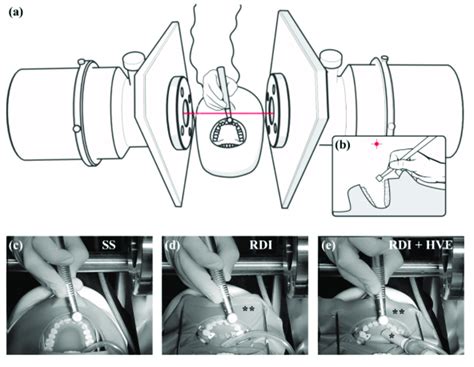 Experimental Design Using Simulated Patient And Laser Diffraction For Download Scientific