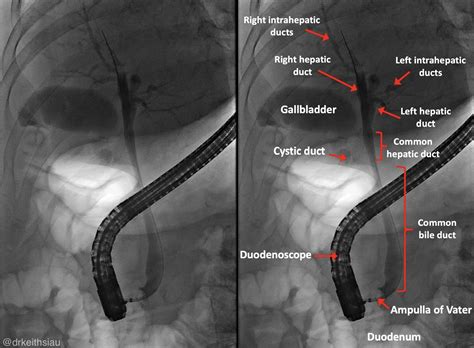 Biliary Tree Anatomy Anatomy Of The Gallbladder And Biliary Tract