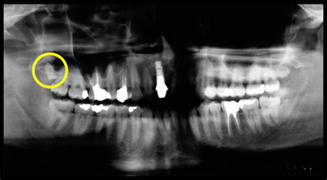 Microdont Dr Gs Toothpix