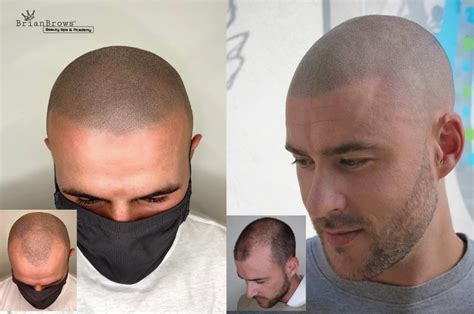 All About Scalp Pigmentation All About Scalp Pigmentation