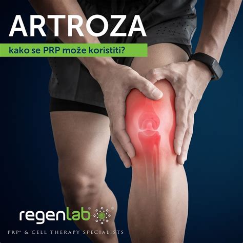 Smiljka Mileusnić Adžić On Linkedin Prptreatment Regenlab