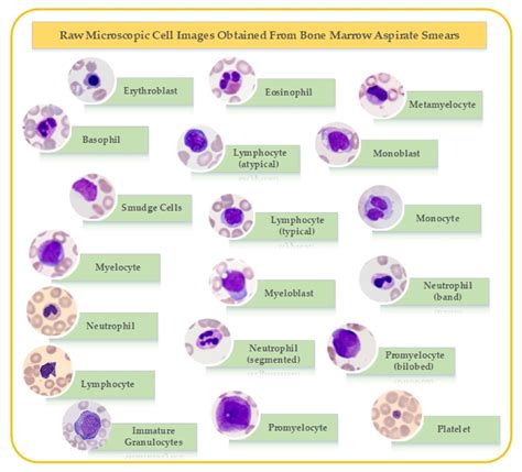 Basophilic Myelocyte