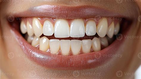 Beautiful Smile Showcasing Healthy White Teeth Close Up Of A Smiling