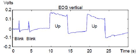 b eye movement and blinking detection vertical eog download scientific diagram