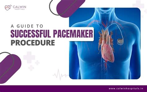 Successful Pacemaker Surgery Procedure Calwin Hospitals