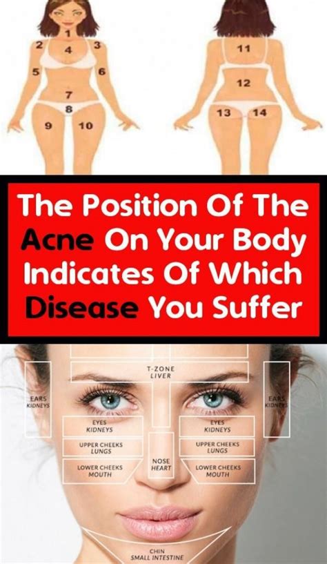 Lower Back Acne Causes Understanding The Causes And Treatment Of Female Back Acne