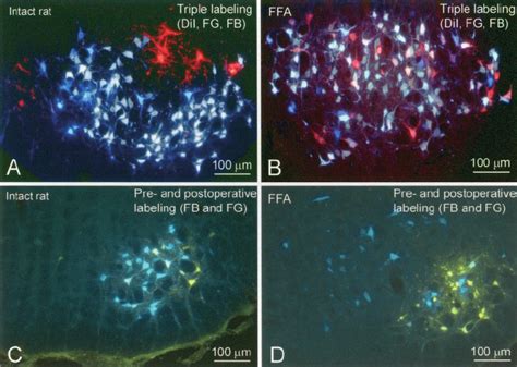 Estimation Of Postoperative Axonal Branching A B And Accuracy Of