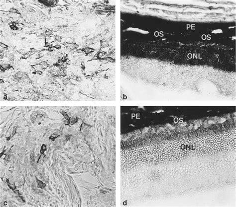 A D Immunocytochemical Demonstration Of Rod Opsin In The Pineal Organ