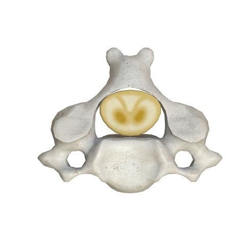 Posterior Cervical Laminoplasty System Cervical Plates With Side Block