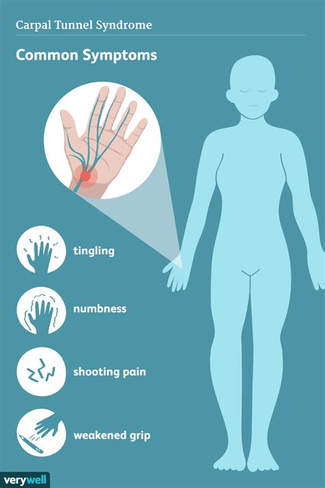 Carpal Tunnel Syndrome Symptoms And Complications