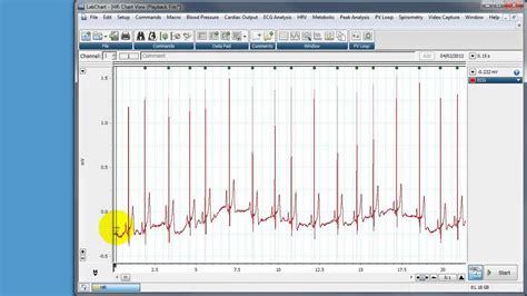 Using A Macro In LabChart To Calculate RR Intervals And Heart Rate Variability HRV YouTube