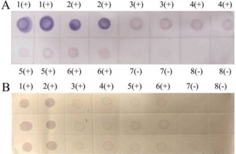 What Is The Difference Between Elisa And Dot Elisa Pediaacom
