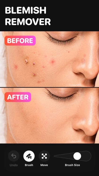 Touch Retouch Erase Objects By Ilya Razuvaev