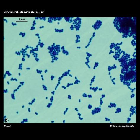 Enterococcus Faecalis En Orina