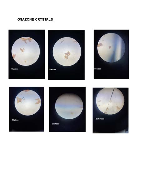 Osazone Crystals Biochemistry Bachelor Of Science In Nursing