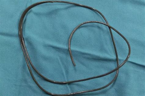 Man Inserts 80cm Earphone Wire Into Penis In Weird Sex Act Daily Star