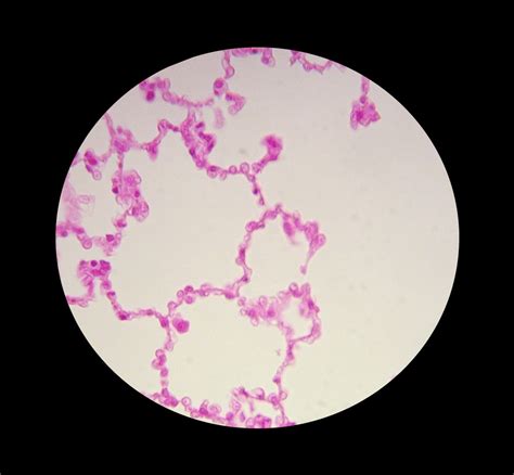 Alveoli Diagram Diagram Quizlet