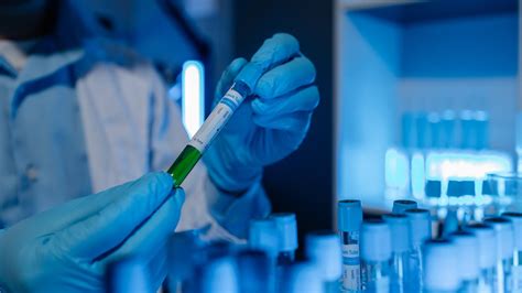 Best Lab Procurement And Ordering Software Faqs And Reviews