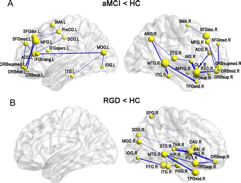 Topologically Convergent And Divergent Structural Connectivity Patterns Between Patients With