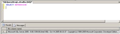 How To Check The Sql Edition And Version Information Sql Server Teacher