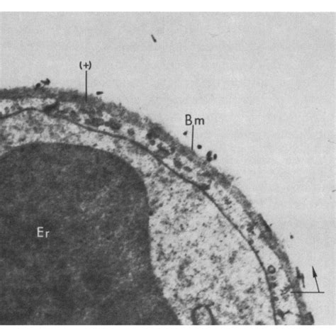 Pdf Electron Microscopic Quantification Of Diabetic Microangiopathy