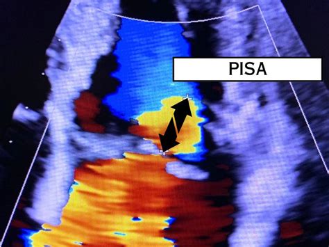 Who Is Pisa The Echo Journal