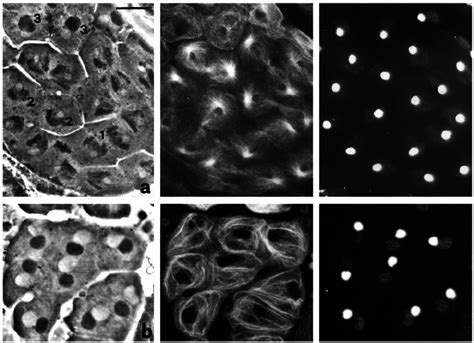 Spermatid Differentiation In D Melanogaster Row A Partial Cyst With Download Scientific