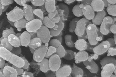 Vesicles Micrograph