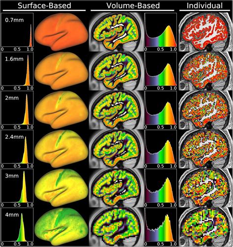 The Impact Of Traditional Neuroimaging Methods On The Spatial
