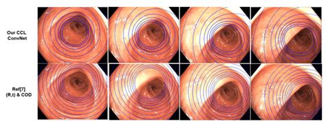 Paper Learning Colon Centerline From Optical Colonoscopy A New Way To