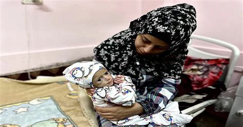 Η έξι μηνών Siwar Ashour γίνεται το τραγικό σύμβολο της πείνας στη Γάζα