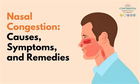 Nasal Congestion Causes Symptoms And Remedies