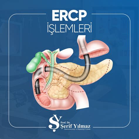 Ercp Prof Dr Şerif Yilmaz