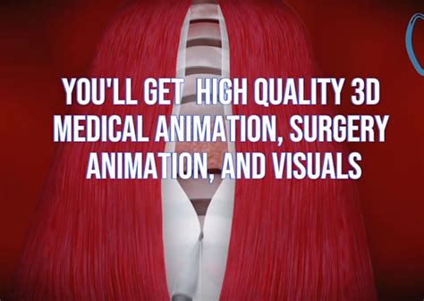 Create High Quality 3d Medical Animation Surgery Animation Visuals By