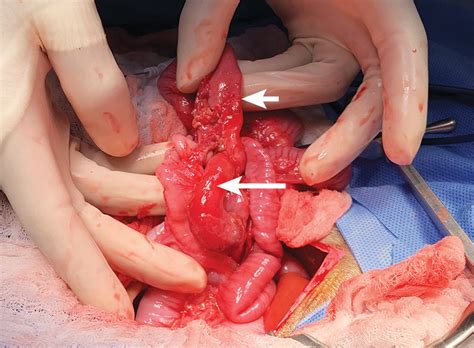 Intussusception Reduction Clinicians Brief