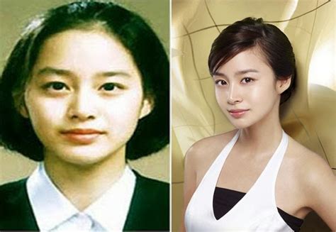 Good Plastic Surgery Before And After Did Kim Tae Hee Have Plastic Surgery