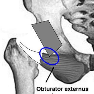 Example Illustration Of The Spatial Relation As Shown In The Mri Images