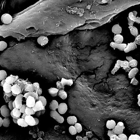 In Vitro Human Epidermis With Sebum For Oily Skin And Acne Studies