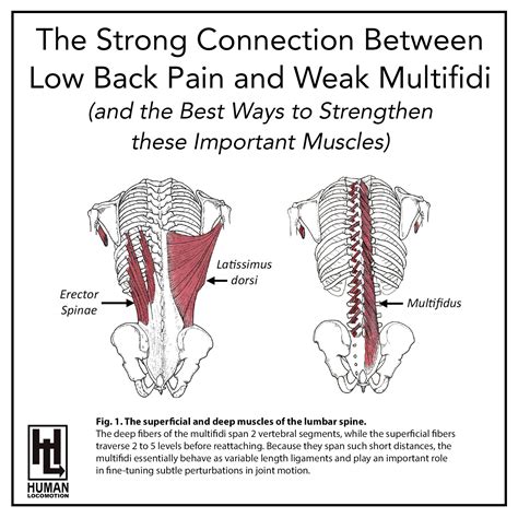The Strong Connection Betweenlow Back Pain And Weak Multifidiand The