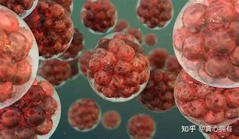 同时出现硬皮病和红斑狼疮的症状，可能是混合性结缔组织病！ 知乎