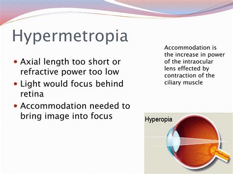 Ppt Refractive Errors Refraction And Contact Lenses Powerpoint