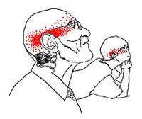 Suboccipital Stretch