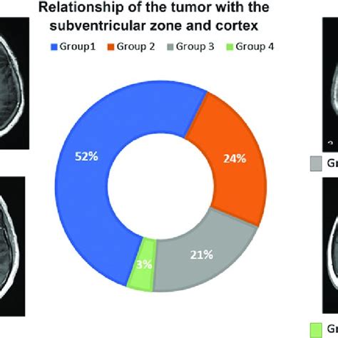 The Mri Based Classification Of The Tumor Location In 38 Patients With