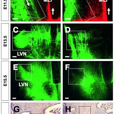 A Schematic Diagram Of The Vestibular Nuclear Complex Vnc And The Download Scientific