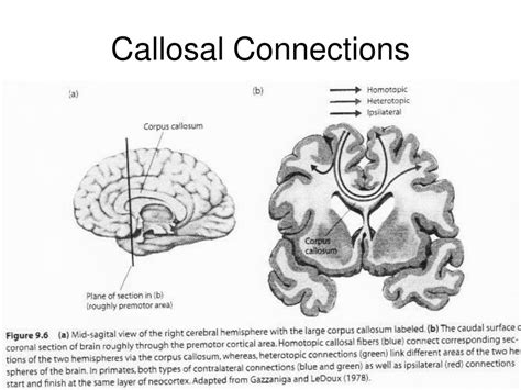 Ppt Dominant Hemisphere Identification Powerpoint Presentation Free Download Id844803