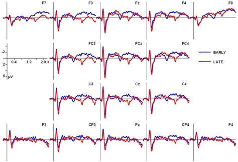 Grand Average Erps Adjusted To A Prestimulus Baseline Of 200 Ms For Download Scientific Diagram