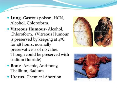 Preservation Of Viscera Pptx