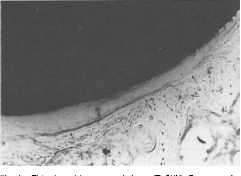 Figure 1 From Biomaterials For Orthopedic Surgery In Osteoporotic Bone