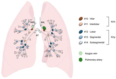 N1 Staging In Non Small Cell Lung Cancer Current Situation